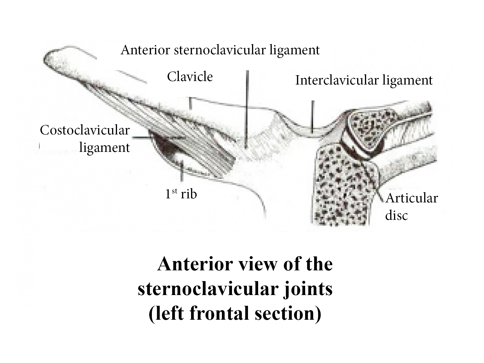 Complications in ports: pinch off syndrome - VascuFirst