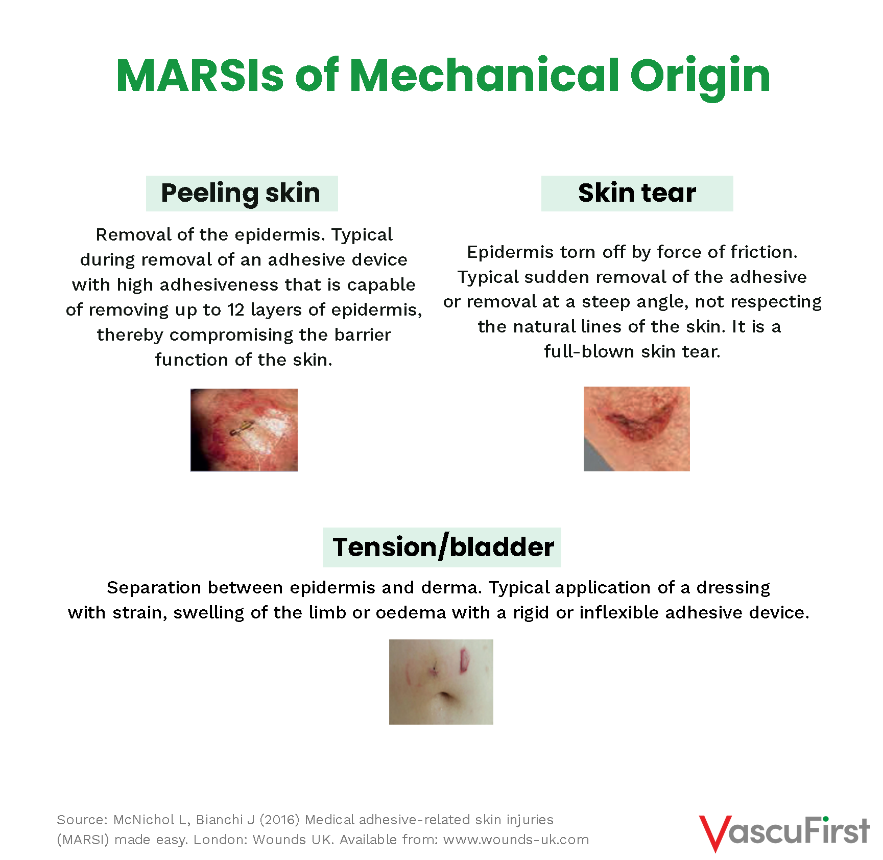 Cutaneous Complications in Vascular Access: MARSI - VascuFirst