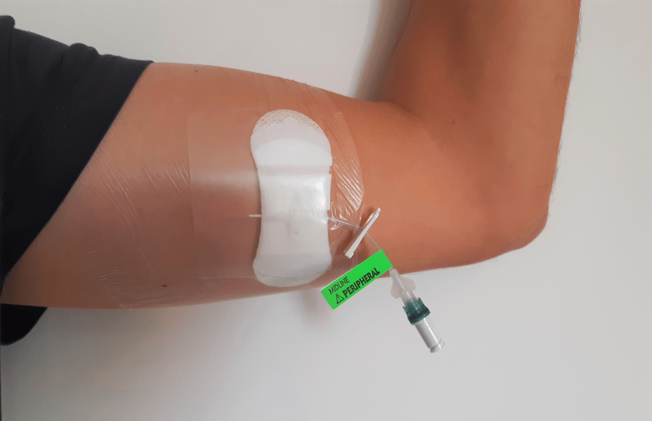 Midline catheter: placement and maintenance protocol - VascuFirst