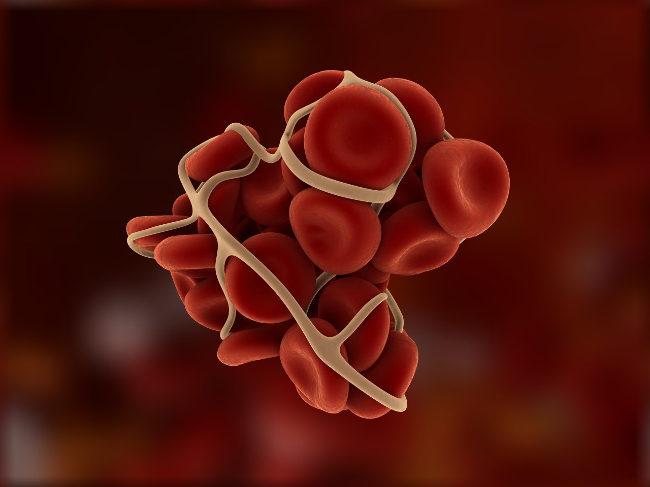 5 things to know about thrombosis in PICCs - VascuFirst