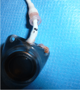 Extravasation: Causes and treatment - VascuFirst