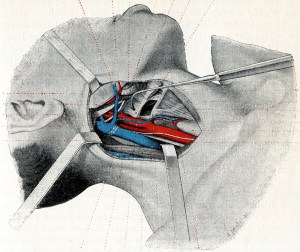 Overview of anatomy and physiology related to vascular access: veins of ...