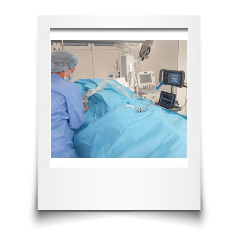 3 tips for proper PICC-port placement - VascuFirst