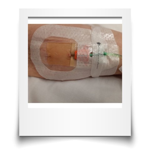 SIP-2 Protocol: Making PICC Insertions Easier - VascuFirst
